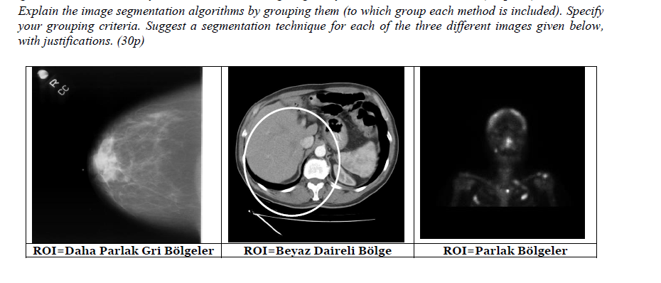 Explain The Image Segmentation Algorithms By Grouping