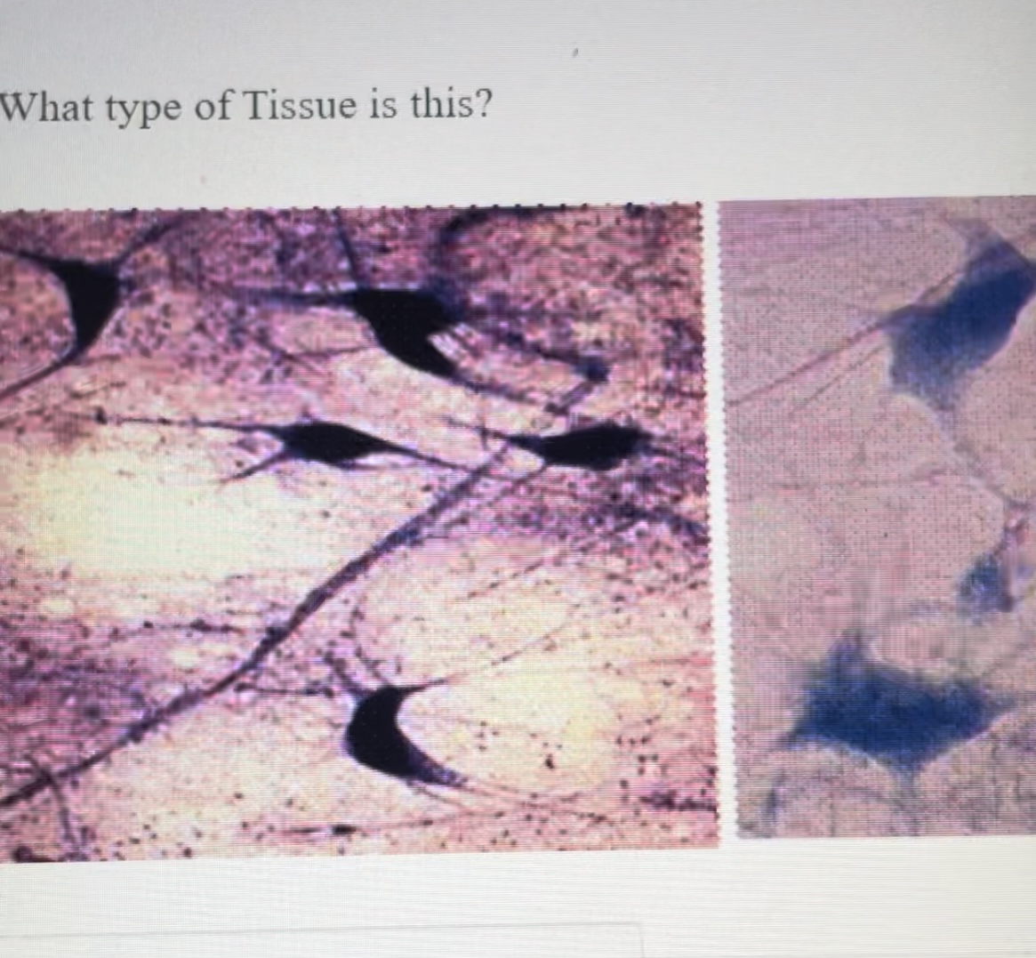 Solved What Type Of Tissue Is This Chegg