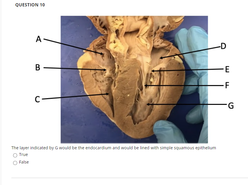 Solved QUESTION 2 The region of the heart indicated by A The | Chegg.com
