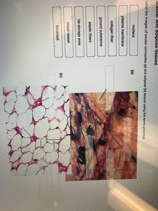Solved Label the images of areolar (a) and adipose (b) | Chegg.com Solved Label the images of areolar (a) and adipose (b) | Chegg.com