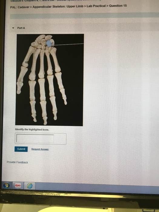 Solved PAL: Cadaver>Appendicular Skeleton: Upper Limb> Lab | Chegg.com