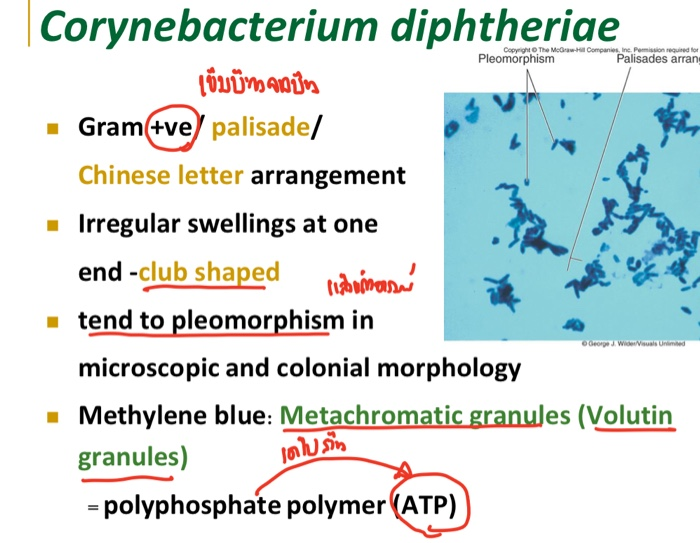 Corynebacterium Diphtheriae Chinese Letters