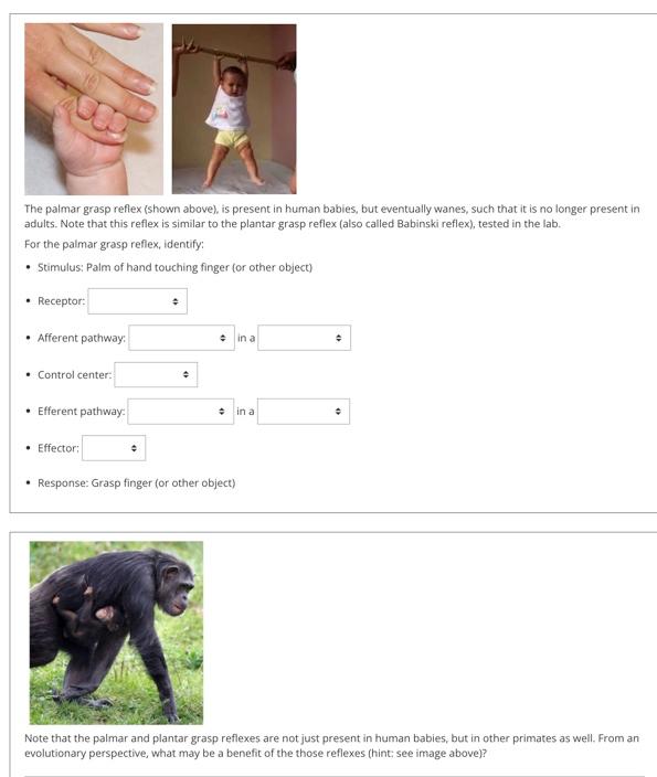 Solved The palmar grasp reflex (shown above), is present in | Chegg.com