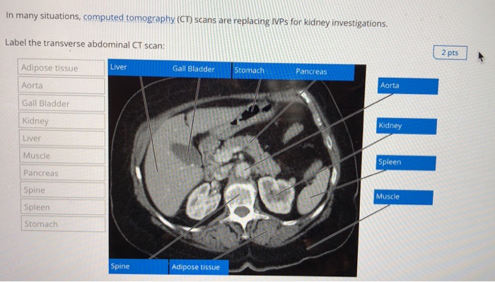 Solved in many situations, computed tomography (CD scans are | Chegg.com