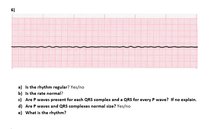 Solved 6) a) Is the rhythm regular? Yes/no b) Is the rate | Chegg.com