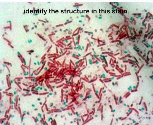 Solved identify the structure in this stain. T. | Chegg.com