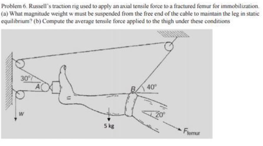 Problem 6. Russell's traction rig used to apply an | Chegg.com