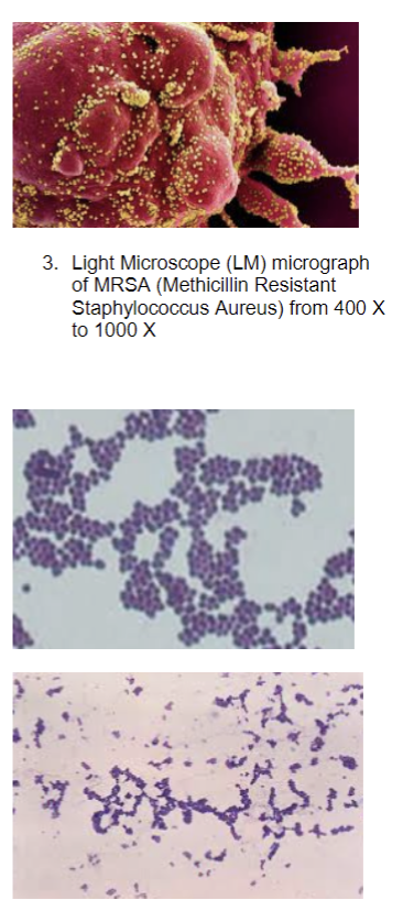 Mrsa Microscope