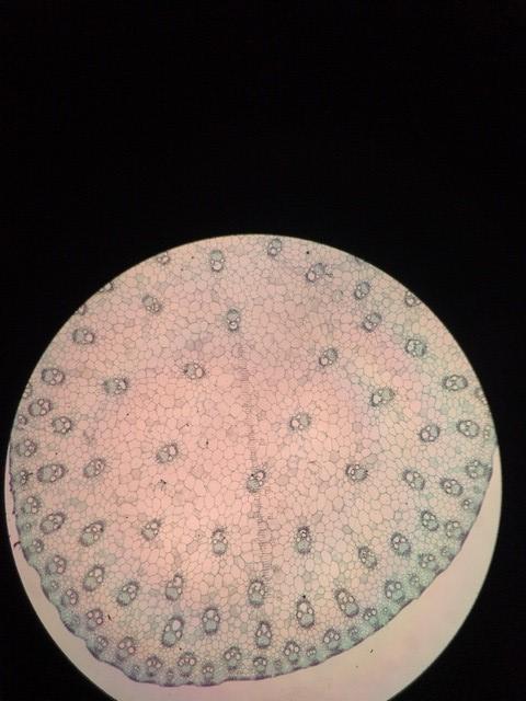 Solved 1.) Medicago (Alfalfa) stem, 100x mag., showing | Chegg.com
