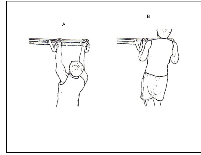 Solved 5. What is the sagittal plane movement of the | Chegg.com