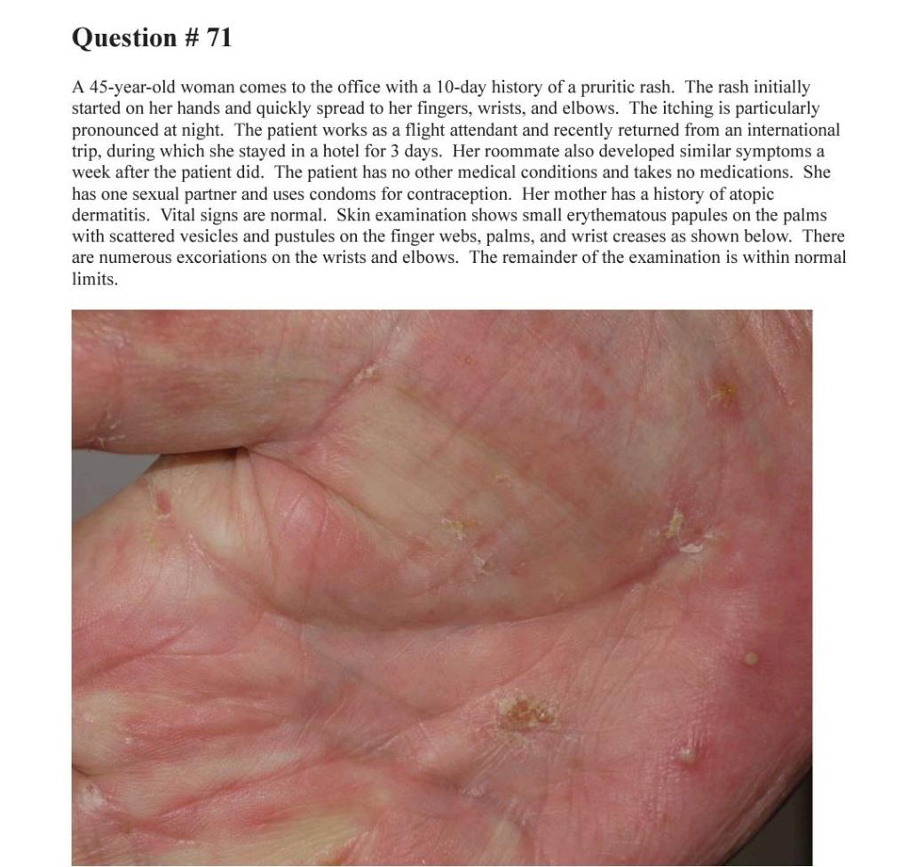 Solved Question # 71 A 45-year-old woman comes to the office | Chegg.com