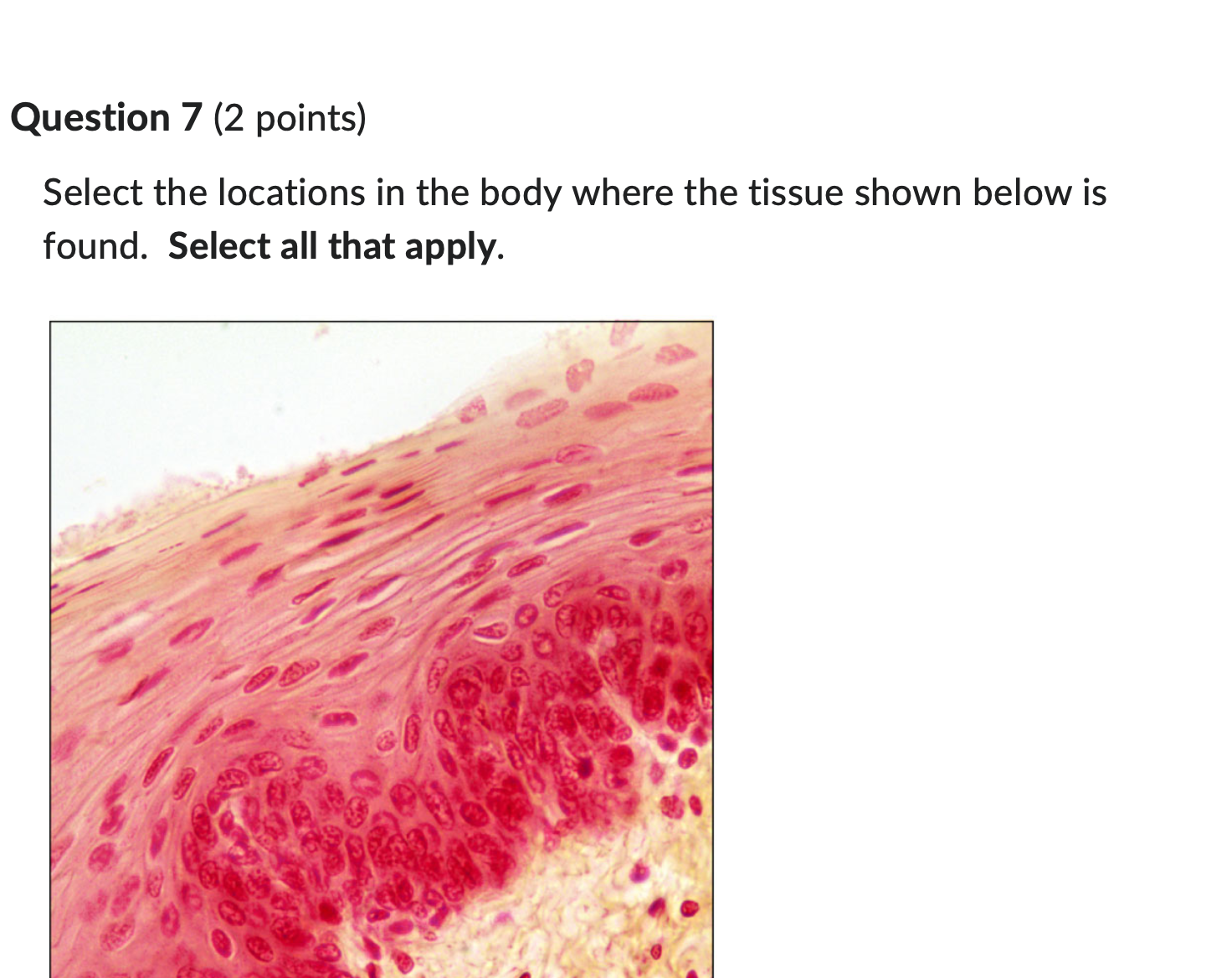 solved-a-what-type-of-tissue-is-shown-in-the-image-above-chegg
