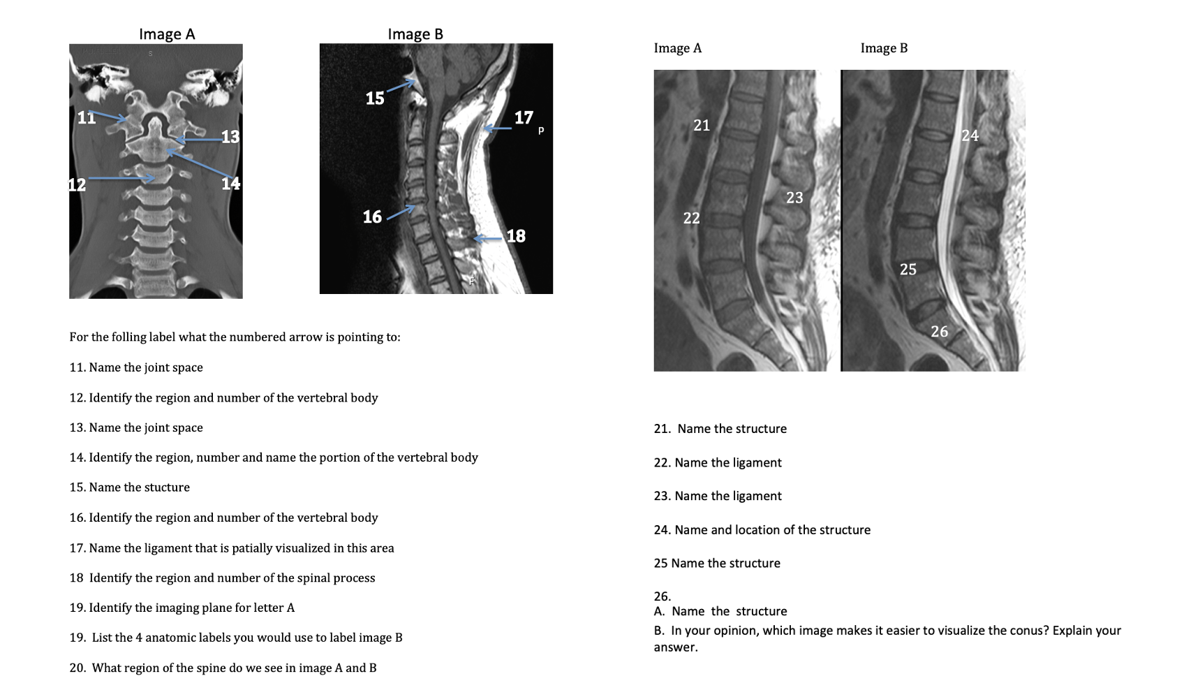 Solved 37. What region of the spine is this? 38. How do you | Chegg.com