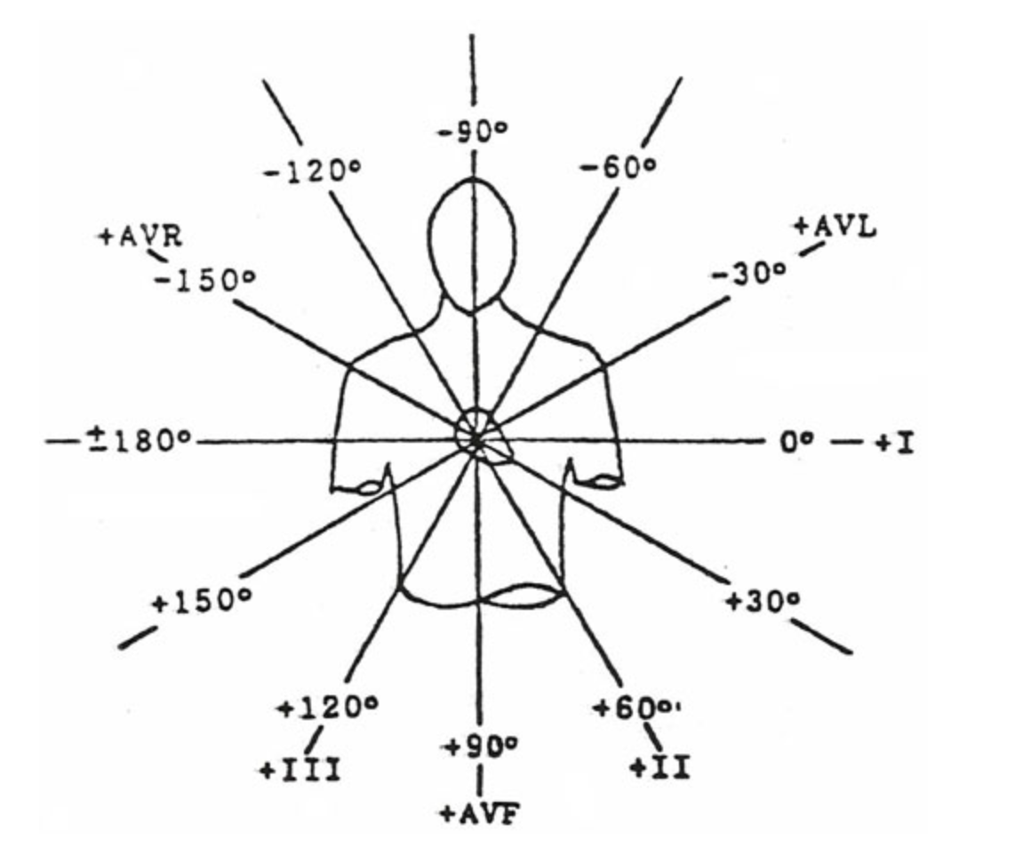 1. Express lead II in terms of aVF (augmented lead | Chegg.com