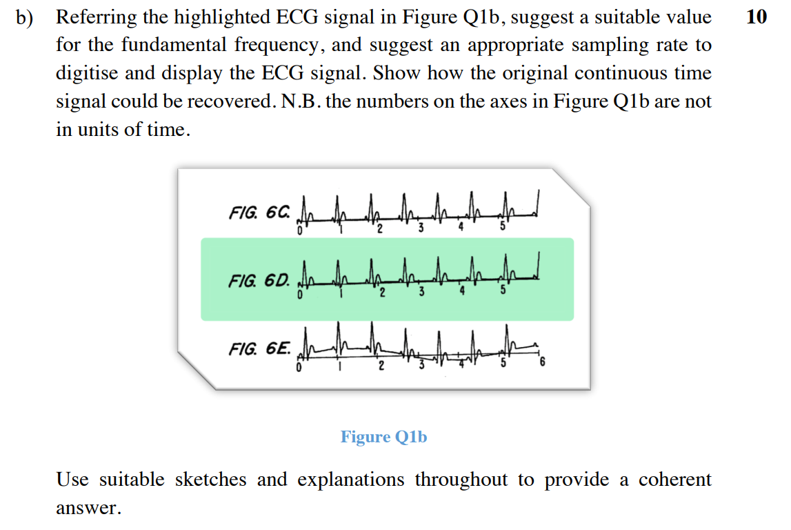Solved 10 2 b) Referring the highlighted ECG signal in | Chegg.com