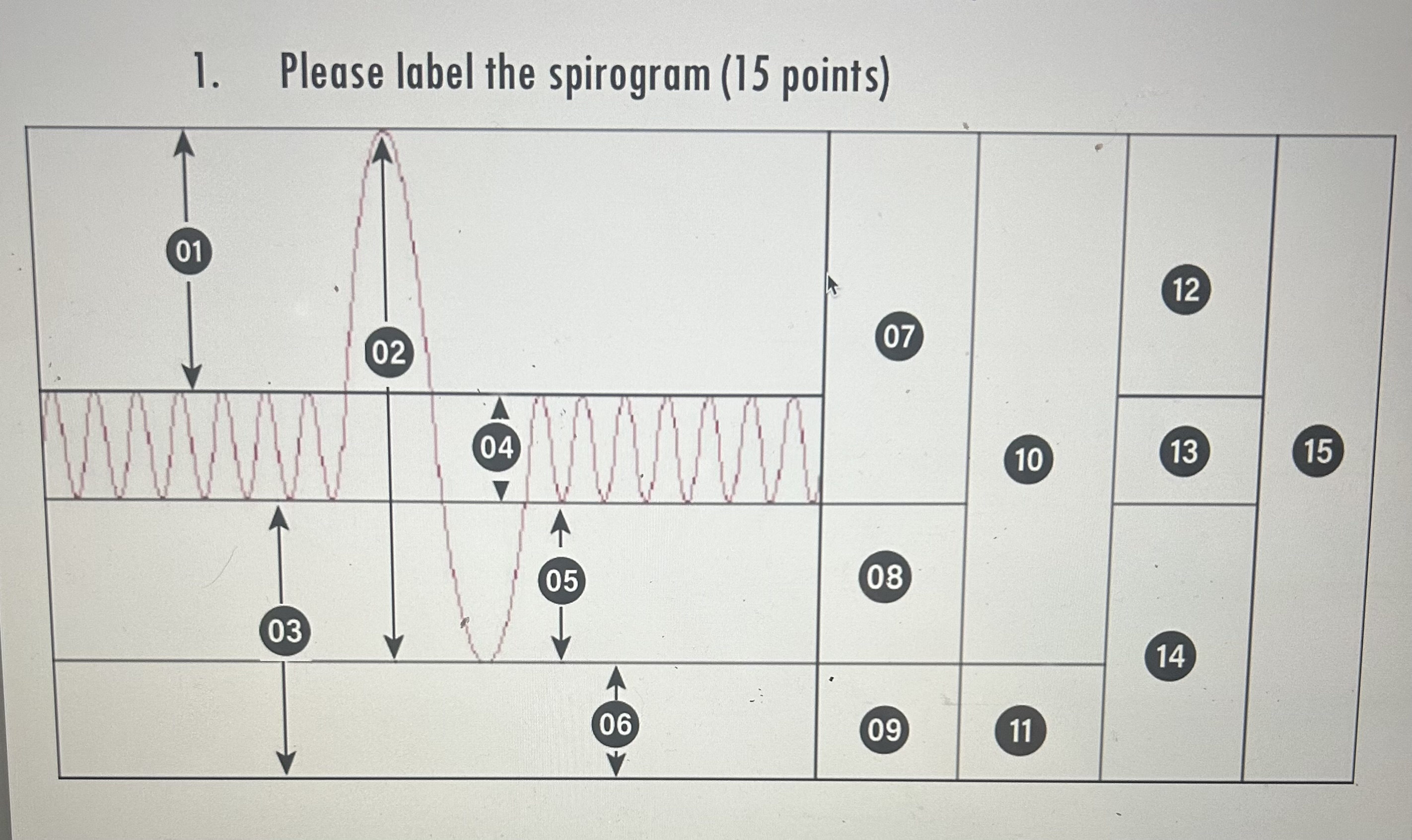 Solved 1 Please Label The Spirogram 15 Points 