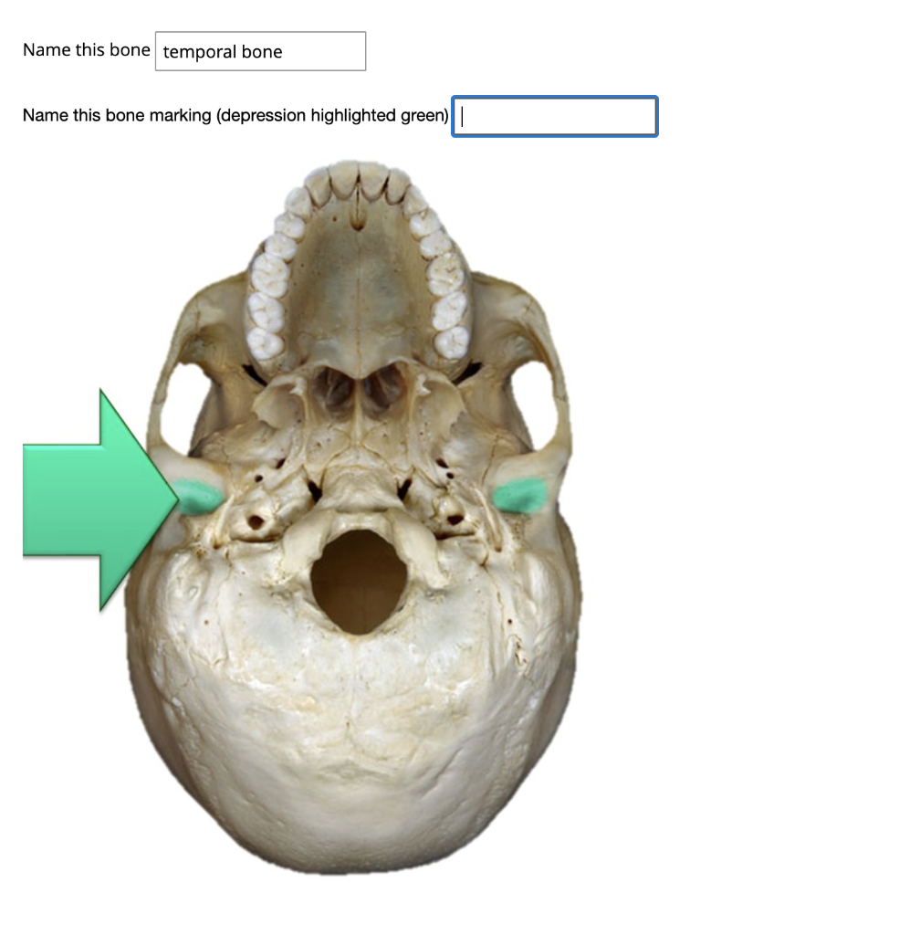Mandibular Fossa Of Temporal Bone