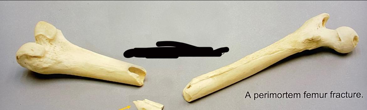 Solved Step 2: Distinguishing postmortem from perimortem | Chegg.com