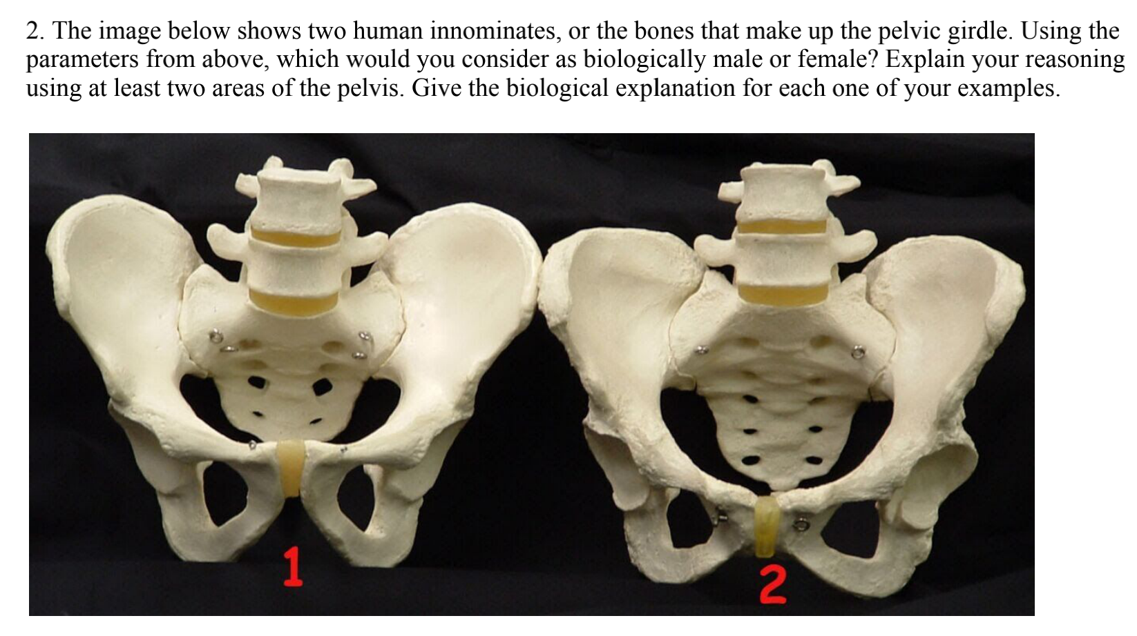Solved 2. The image below shows two human innominates, or | Chegg.com