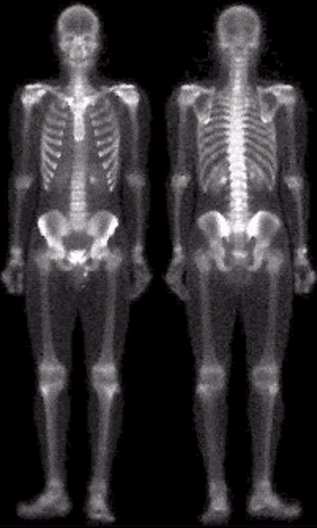 Solved Please consider the skeleton example (Combining | Chegg.com