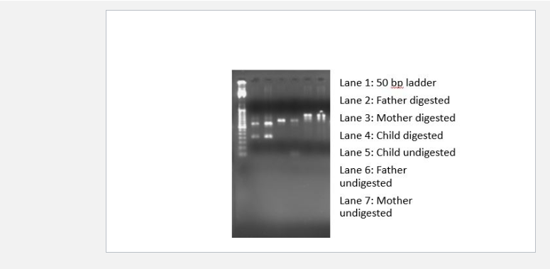 Solved 3 Example The TrackIt™ 50 bp DNA Ladder (2 L) was | Chegg.com