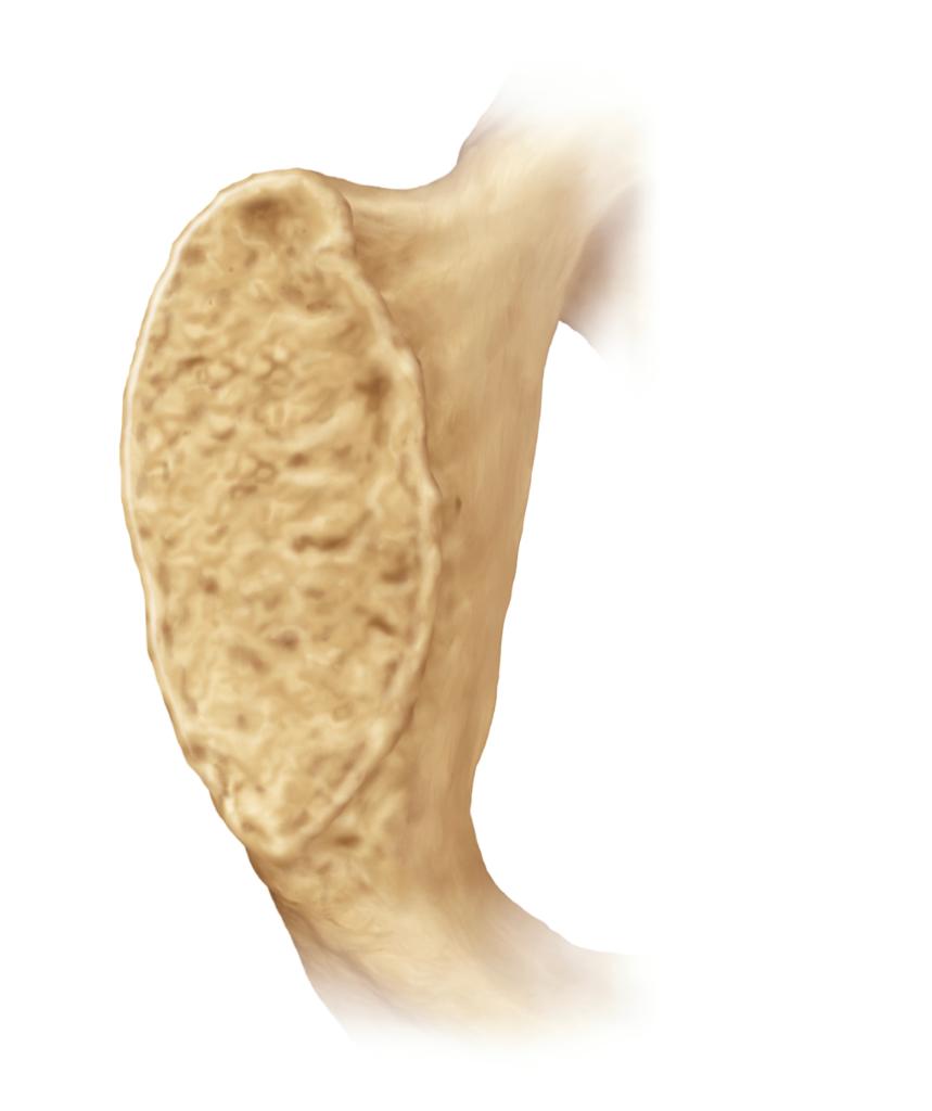 Solved Exercise 3 Aging examine the skeletal material which | Chegg.com