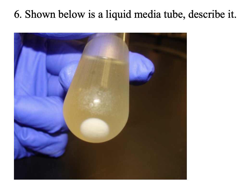 Solved 6. Shown below is a liquid media tube, describe it. | Chegg.com