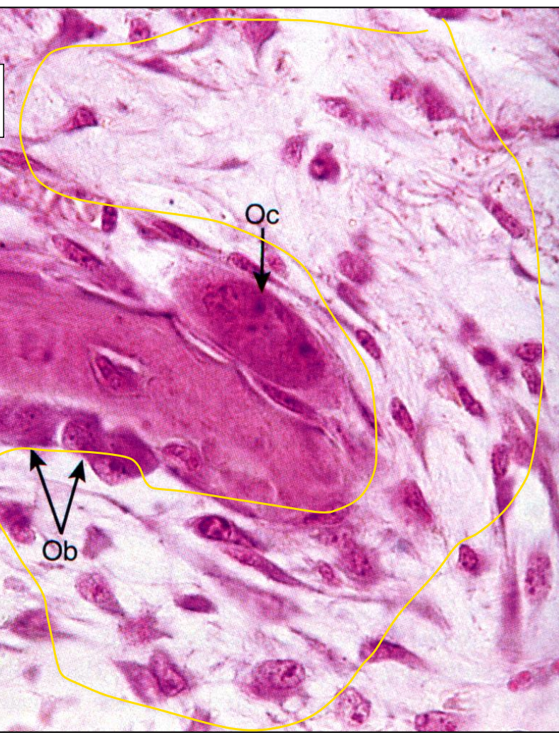 Solved Histology question about bone. Please help me | Chegg.com