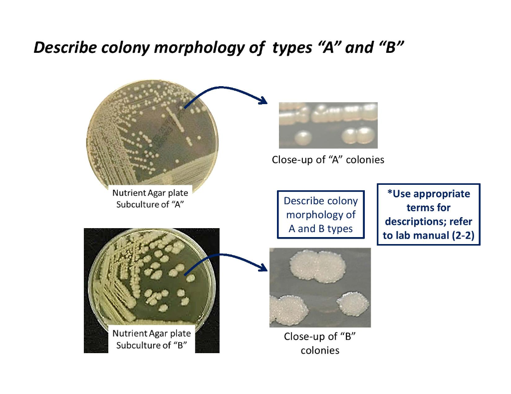 Subculture “A” and “B” onto fresh Nutrient Agar | Chegg.com