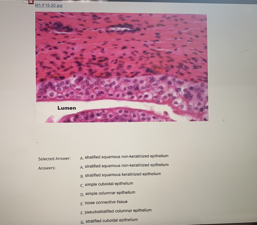 Stratified Squamous Epithelium Non Keratinized Labeled