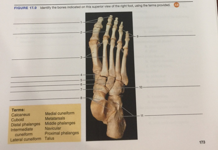 Solved FIGURE 17.9 Identify the bones indicated on this | Chegg.com