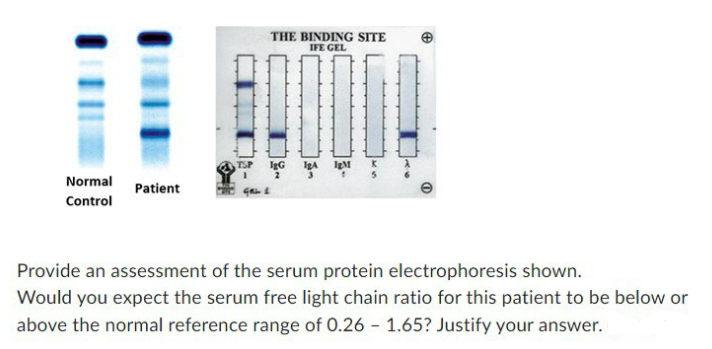 Solved Provide an assessment of the serum protein | Chegg.com