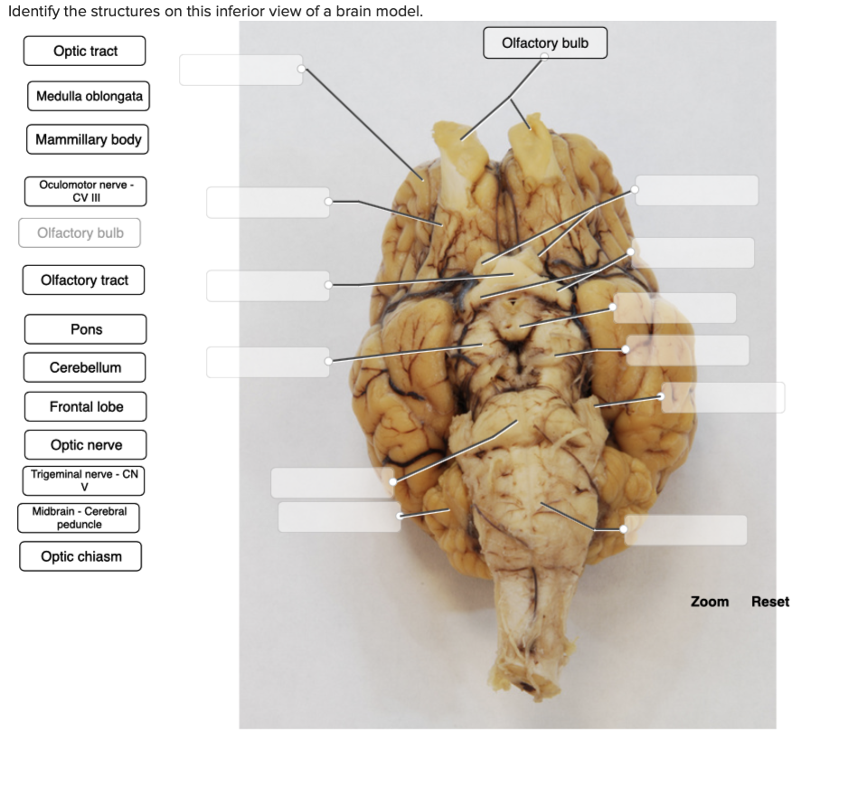 Solved Identify the structures on this inferior view of a | Chegg.com