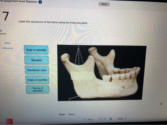 Solved: Label The Structures Of The Bone Using The Hints P... | Chegg.com