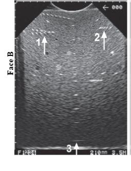 Solved Which resolution is being tested by pin group | Chegg.com
