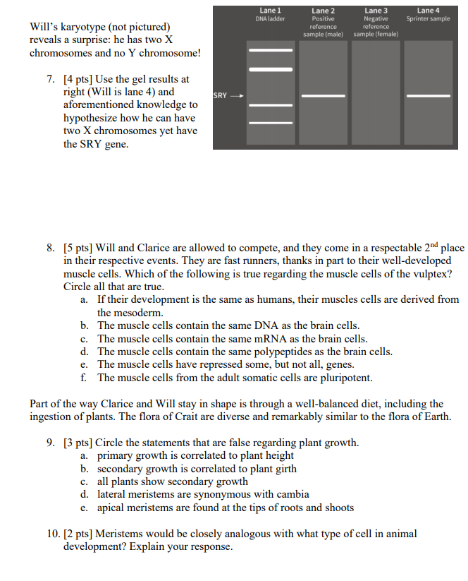 Lane 1 DNA ladder Lane 4 Sprinter sample Lane 2 Lane | Chegg.com