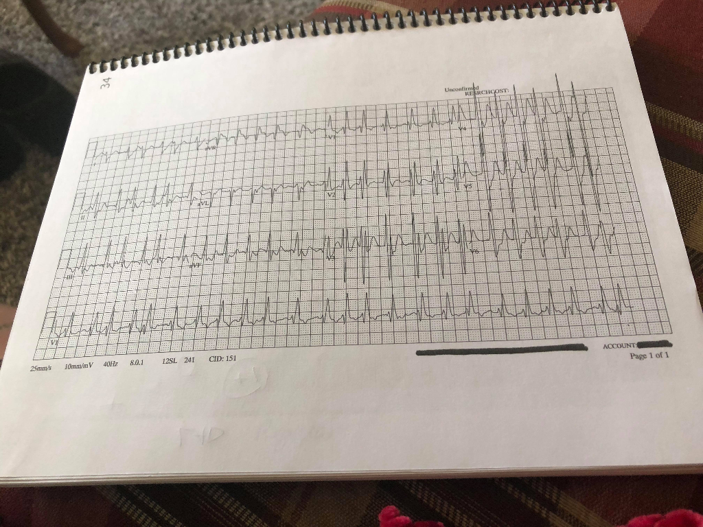 Solved Interpret the ECG. Note any possible abnormalities | Chegg.com