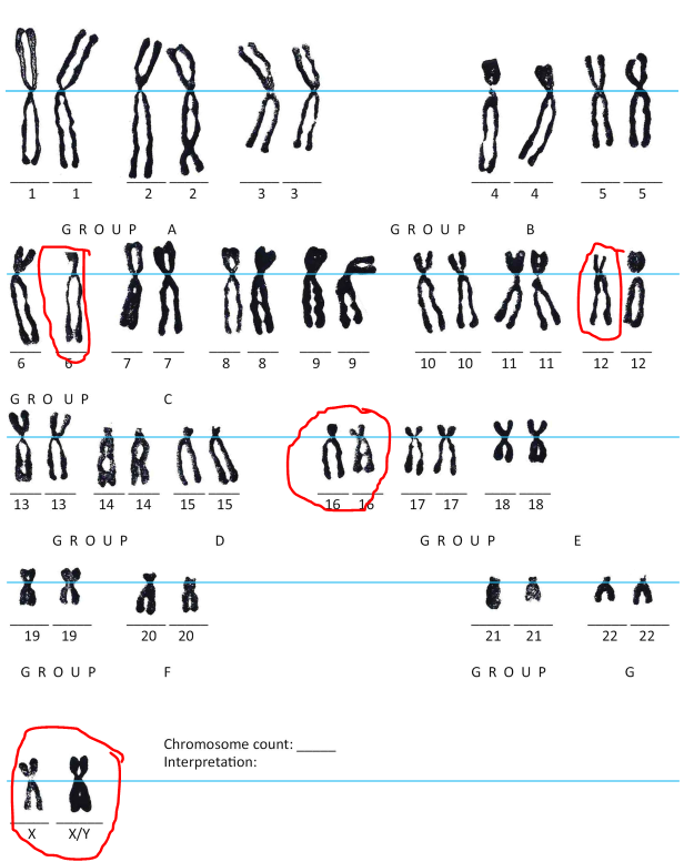 Solved Photographs of the somatic chromosomes of an | Chegg.com