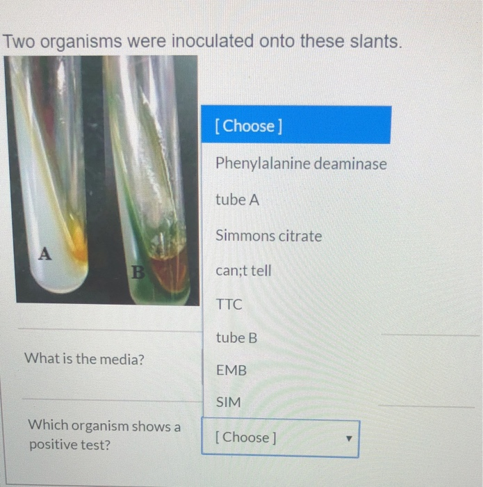 Solved Two organisms were inoculated onto these slants. | Chegg.com