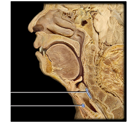 Solved Multiple Choice Thyroid cartilage Vocal fold | Chegg.com