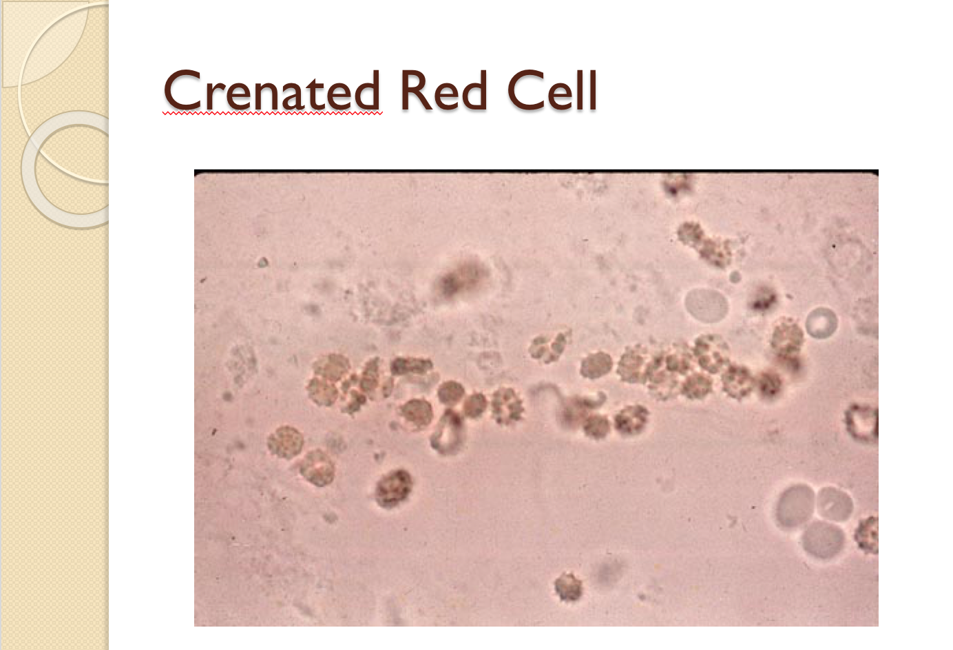 Solved This is for a urinalysis class. This is all the | Chegg.com