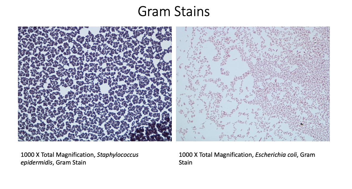 Solved Organism: Staphylococcus epidemm's Total | Chegg.com