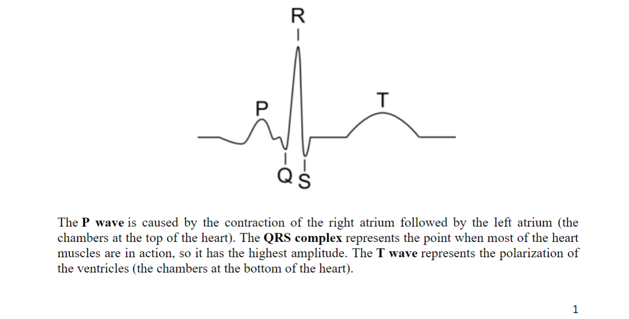 The below picture represents an ECG | Chegg.com