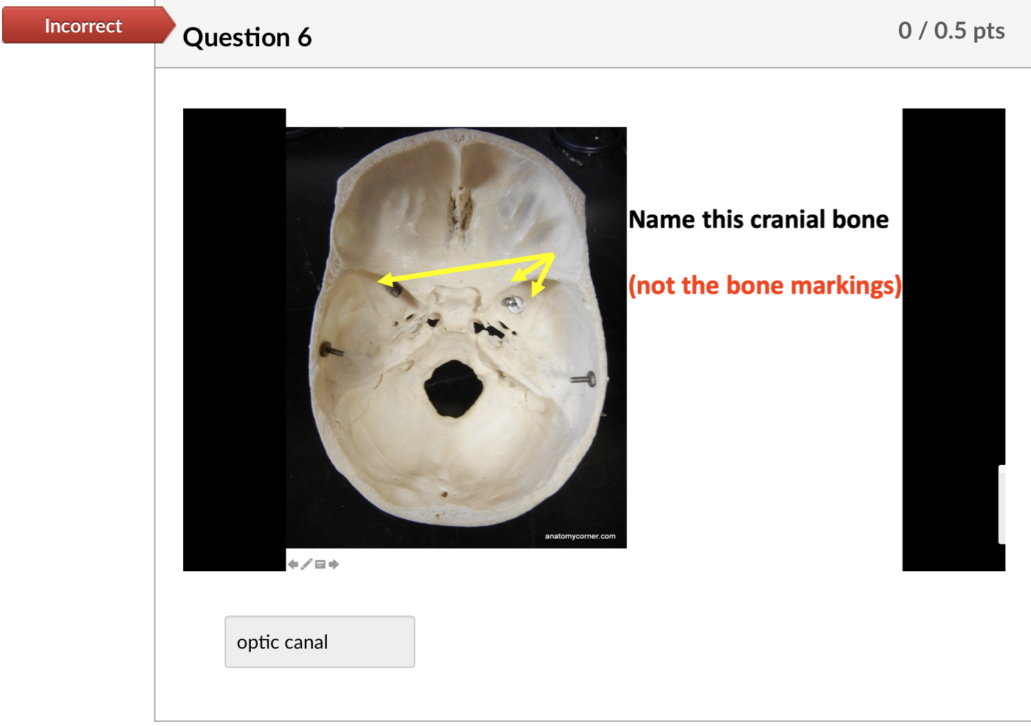 Solved Name this structure A. acromion B. conoid tubercle C. | Chegg.com