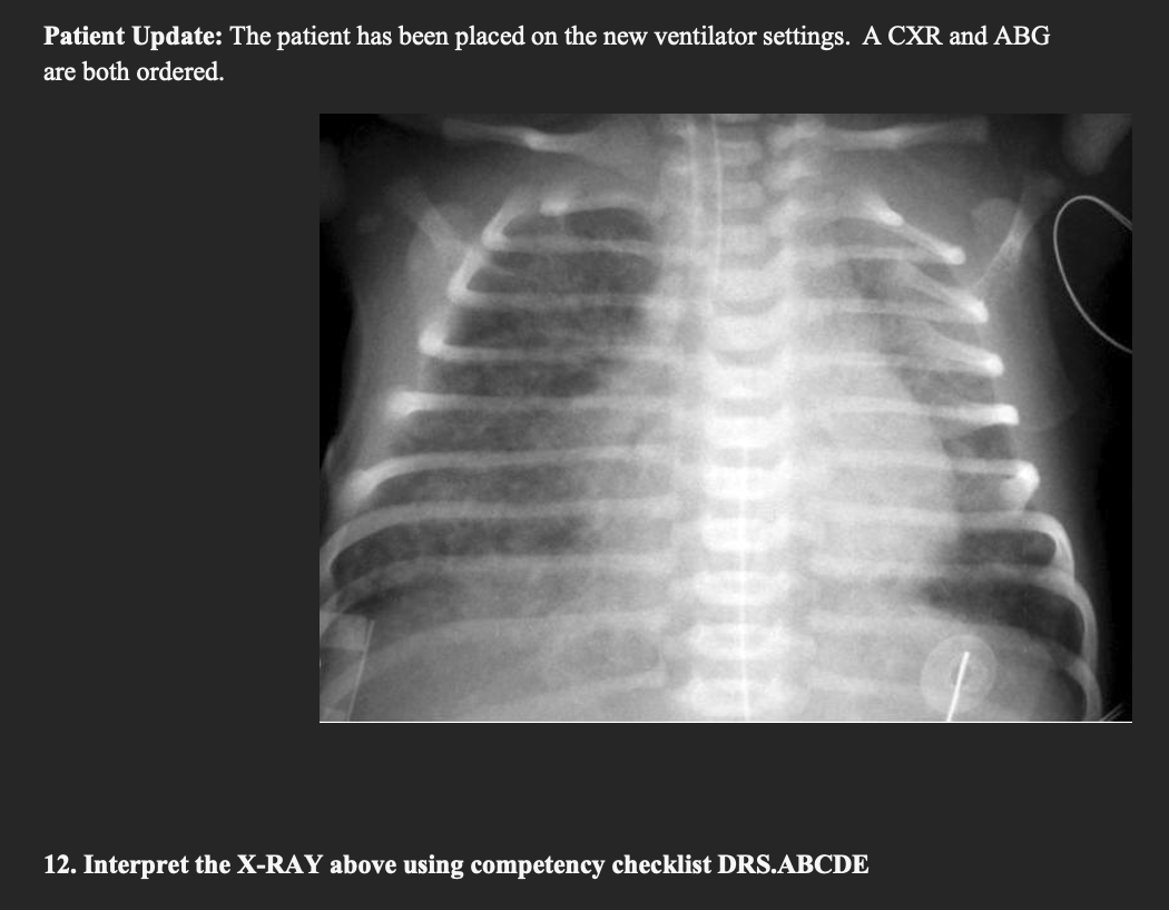 Patient Update: The patient has been placed on the | Chegg.com