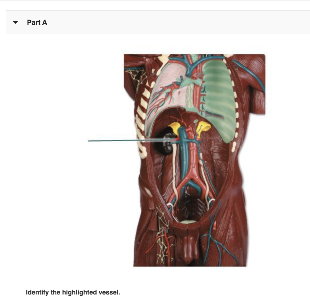 Identify the highlighted structure. From LT VA18 | Chegg.com