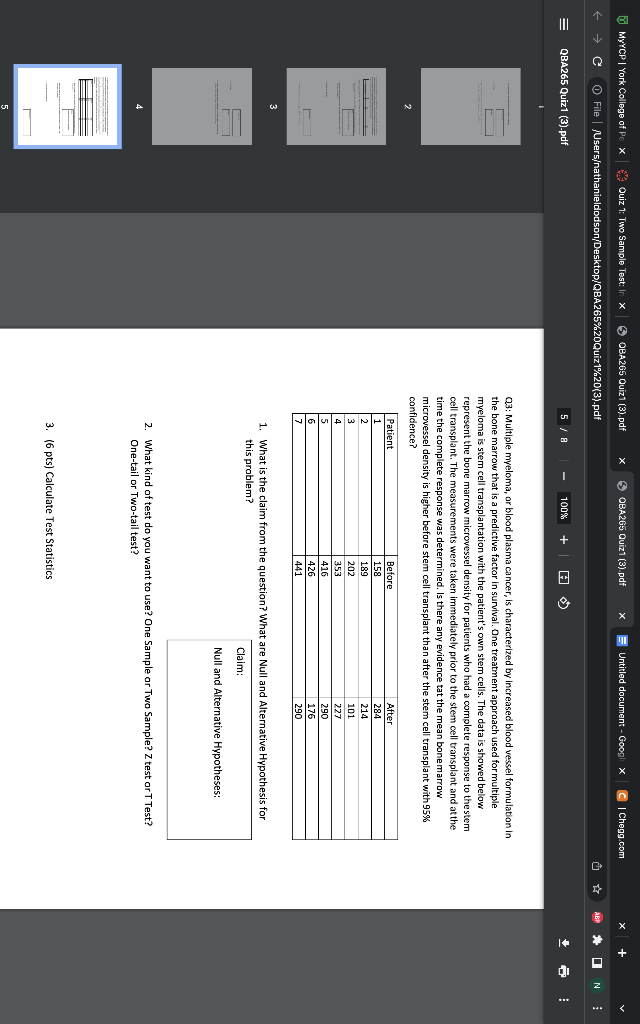 Solved Q3: Multiple myeloma, or blood plasma cancer, is | Chegg.com