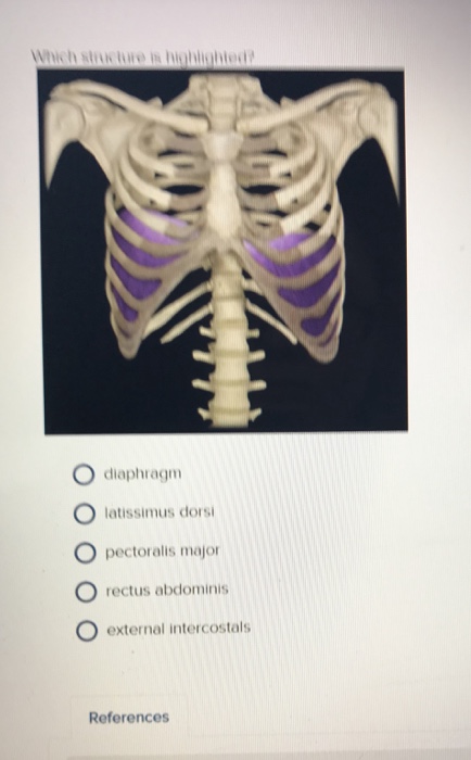 Solved Which structure is highlighted? internal abdominal | Chegg.com