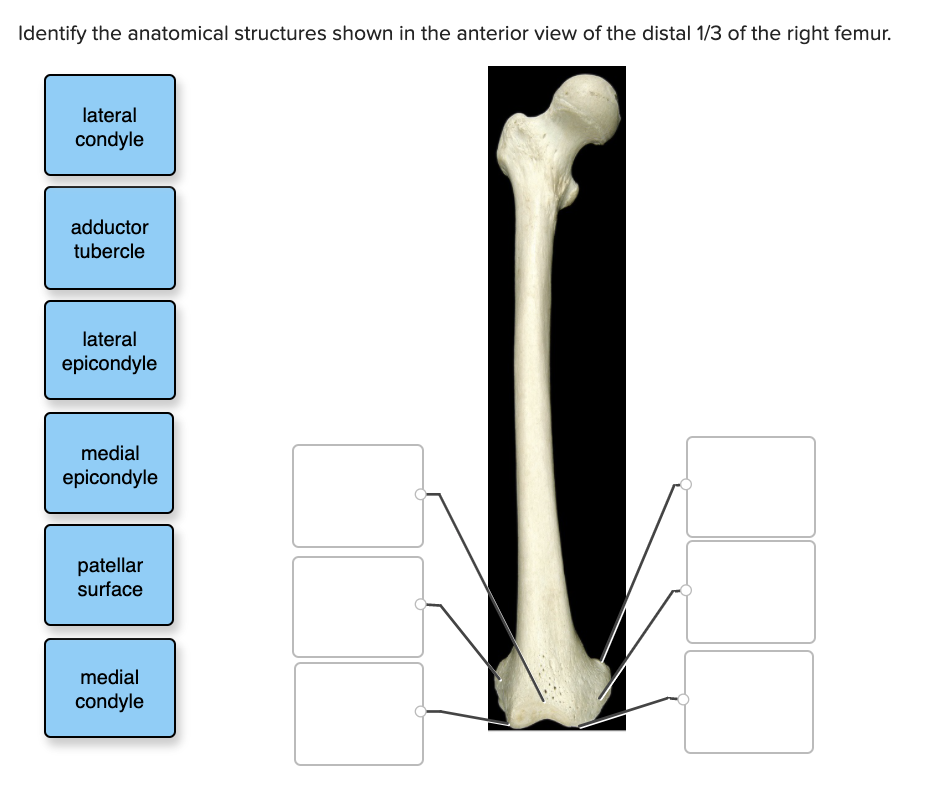 Solved Identify the anatomical structures shown in the | Chegg.com Solved Identify the anatomical structures shown in the | Chegg.com