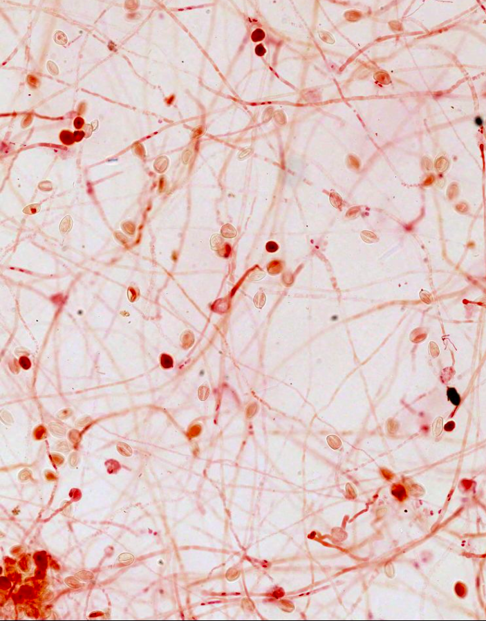 Solved View the pollen slide. Capture an image at | Chegg.com